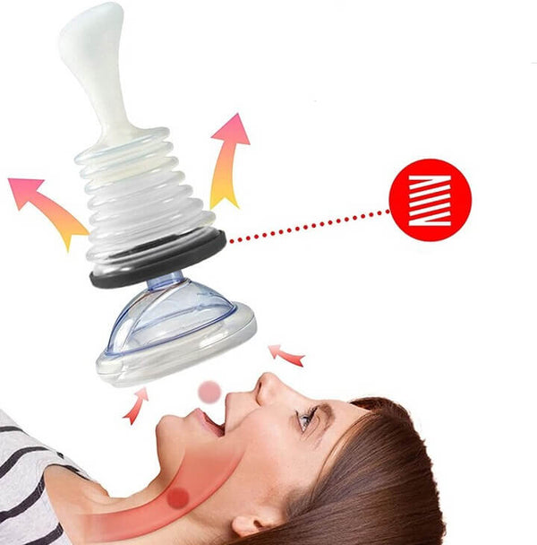 Emergency Choke Kit - Bellezasverige